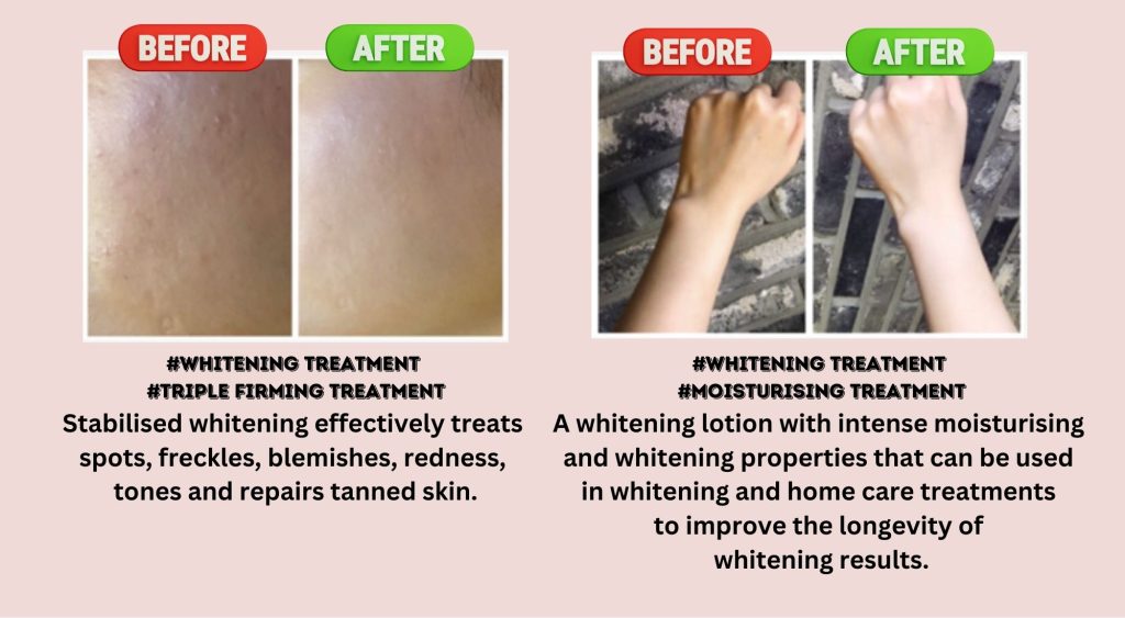 White Tanning Rose.S Face | SMARTSHOP